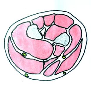 Compartiment: Compartimentsyndroom onderarm | Fysiotransparant