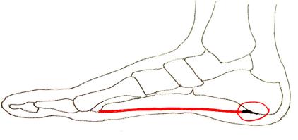 Peesplaat: Klacht peesplaat onder de voet | Fysiotransparant
