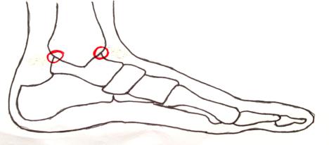 Gewricht e.a structuren: Inklemming enkel | Fysiotransparant