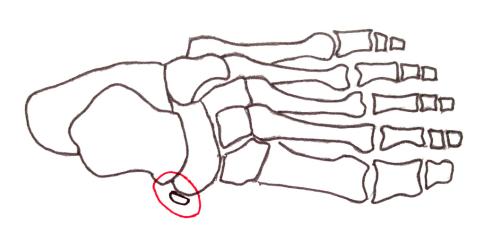 Bot: Extra botje binnenkant voet of buitenkant voet | Fysiotransparant