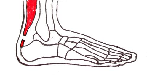 Spierpees: Scheur achillespees | Fysiotransparant