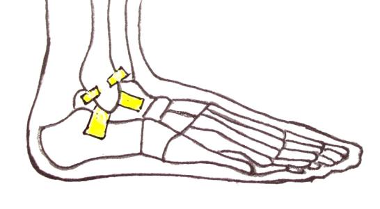 Banden e.a structuren: Verzwikking enkel | Fysiotransparant