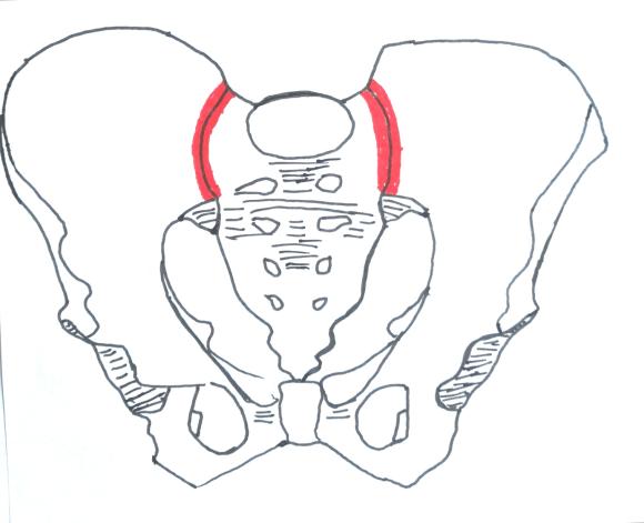 Rug laag: Klacht heiligbeen | Fysiotransparant