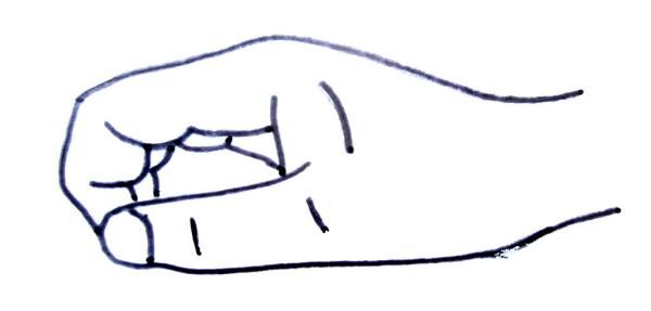 Band: Verzwikking vinger / duim | Fysiotransparant