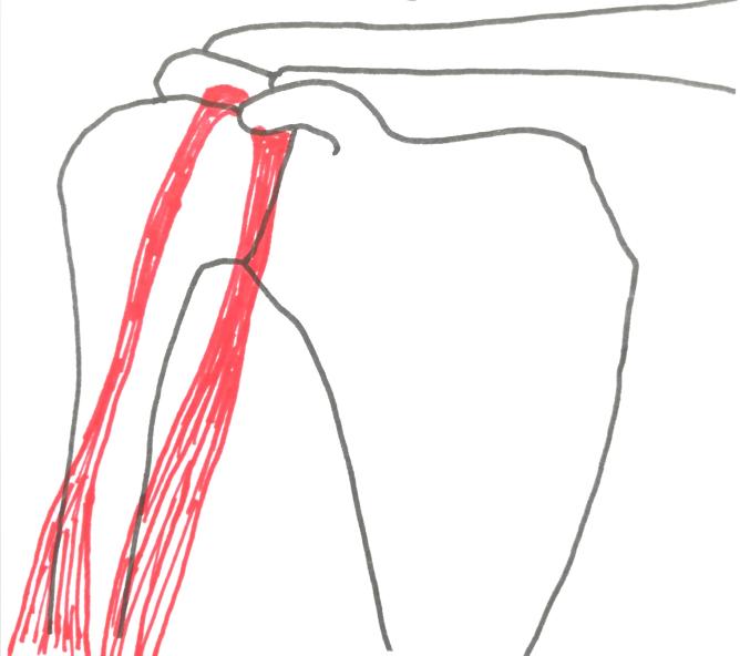 Spierpees: Peesscheur ter hoogte van de schouder - Fysiotransparant